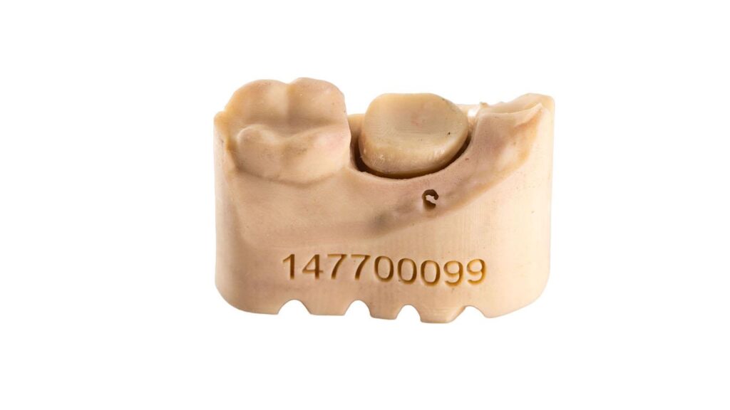 Photo Gallery - Leixir Dental Laboratory Group