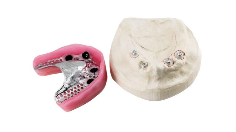 Photo Gallery - Leixir Dental Laboratory Group