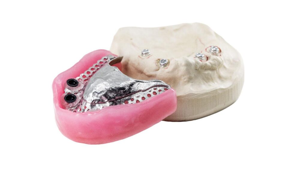 Photo Gallery - Leixir Dental Laboratory Group