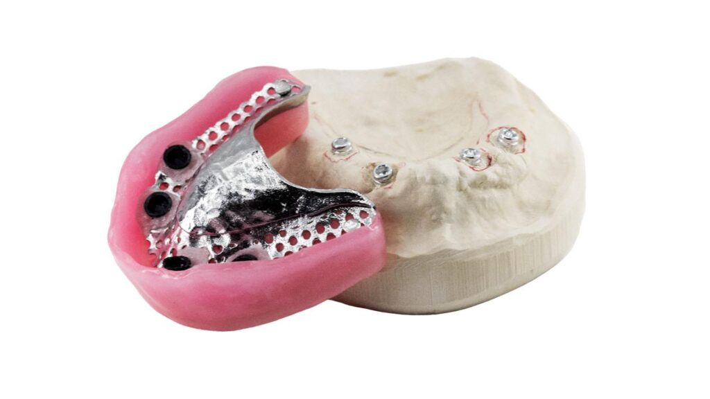 Photo Gallery - Leixir Dental Laboratory Group