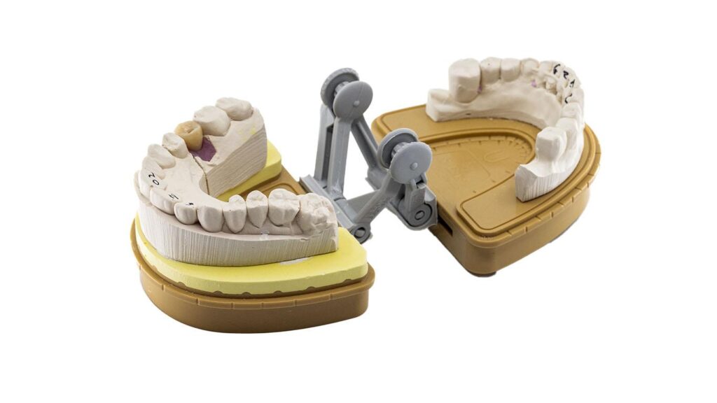 Photo Gallery - Leixir Dental Laboratory Group