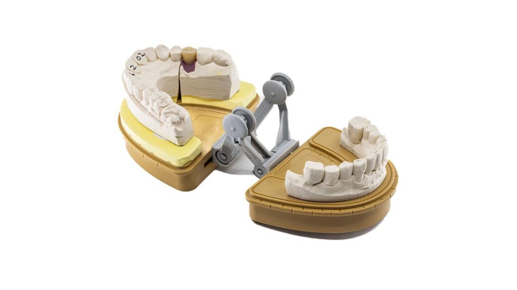 Photo Gallery - Leixir Dental Laboratory Group